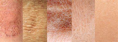 Système cutané :: Medicina